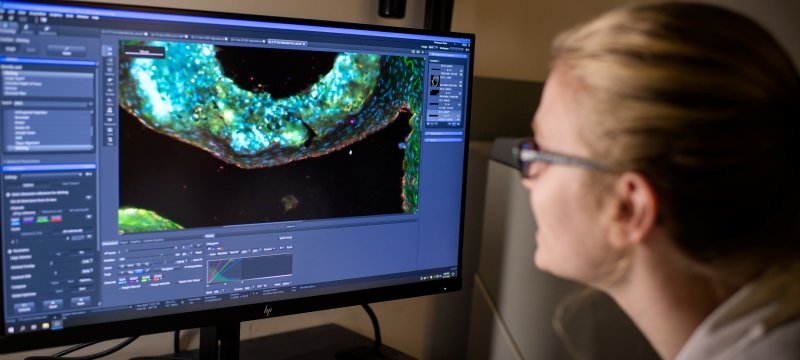 Biomedical Engineering Major | Undergraduate Admissions