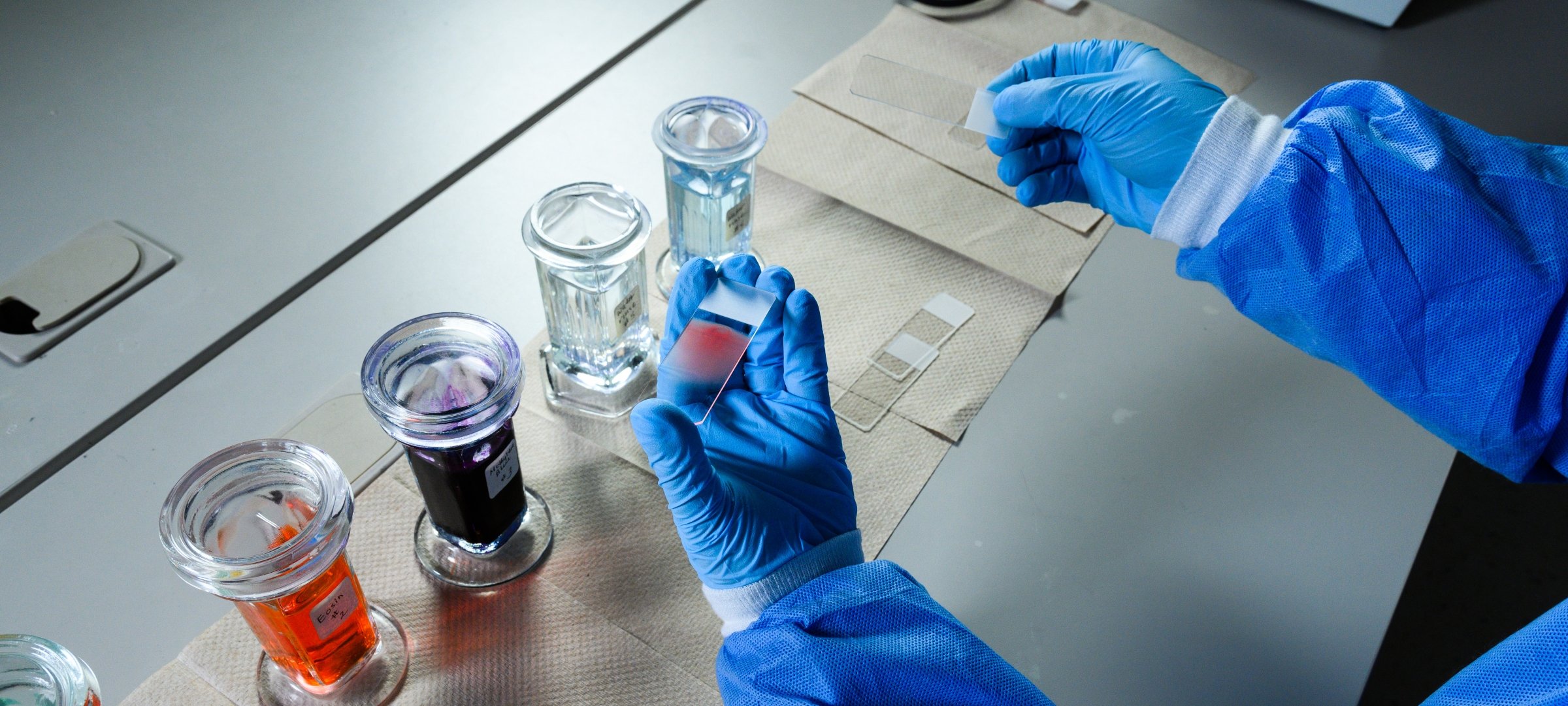 What Is Biomedical Engineering?